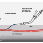 Prevantics® Swab, Swabstick & Maxi Swabstick - PDI Healthcare